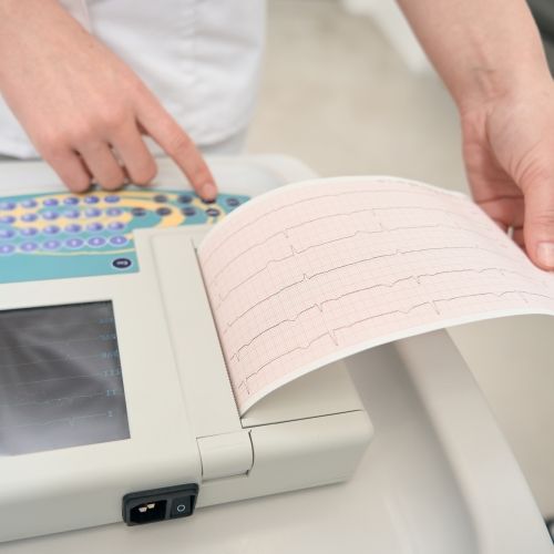 12-Lead ECG Placement | Cardiac Disorders | Nursing CPD