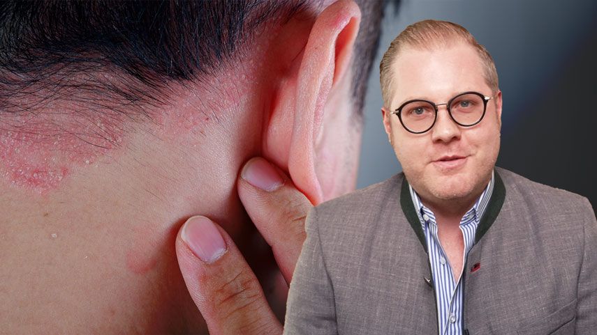 Psoriasis - so individuell wie ihre Patienten | CME Fortbildungen ...