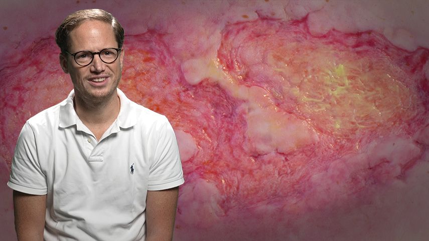 Ulcus | CME Fortbildungen | Doctorflix