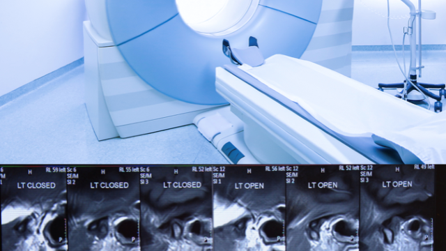 Course 3: MRI Interpretation and TMJ Pathologies
