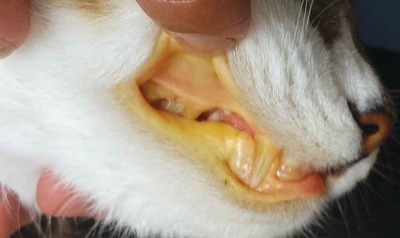 Emergency Management of Triaditis