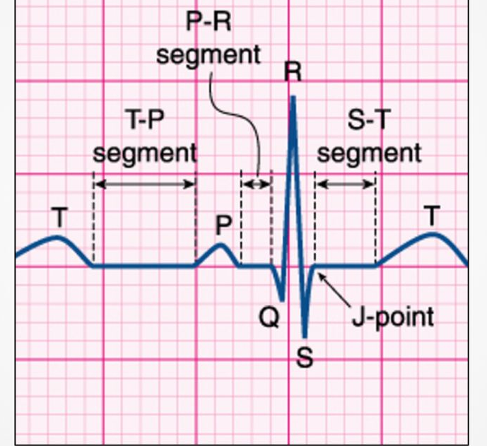 ECG Practice