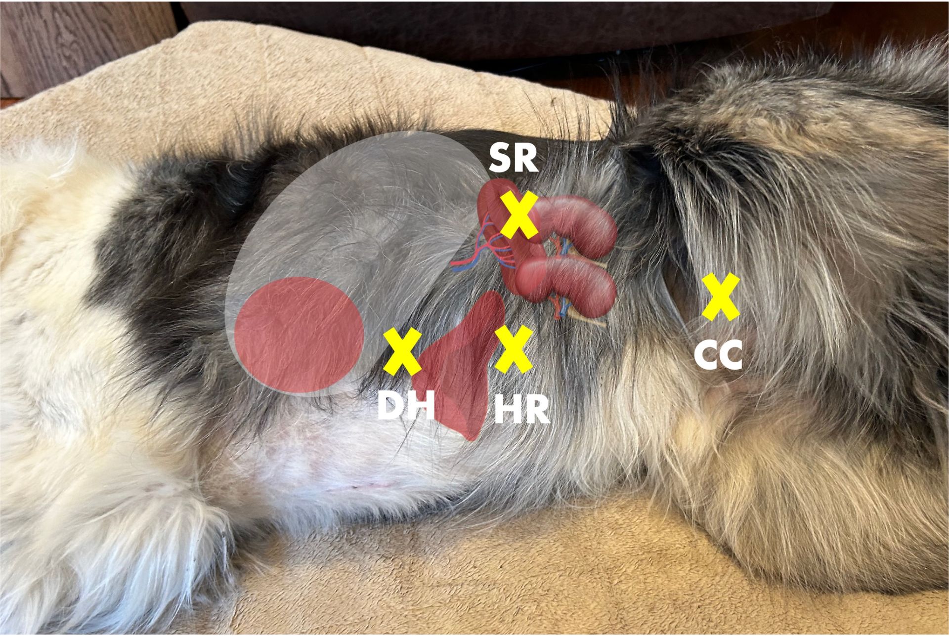 AFAST & TFAST: Quick Ultrasounds for Emergency Patients