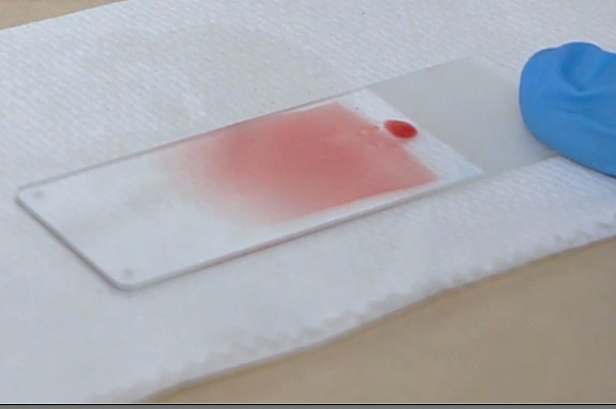 How to Make a Blood Smear ﻿(Feathered Edge)
