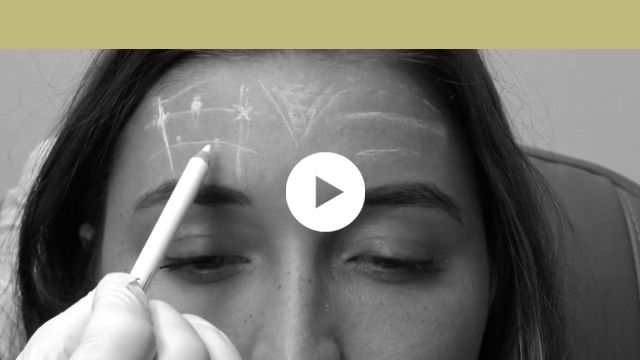 facial indications | upper third - horizontal forehead lines - standard ...