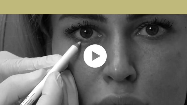 facial indications | upper third - lower eyelid wrinkles and widening ...