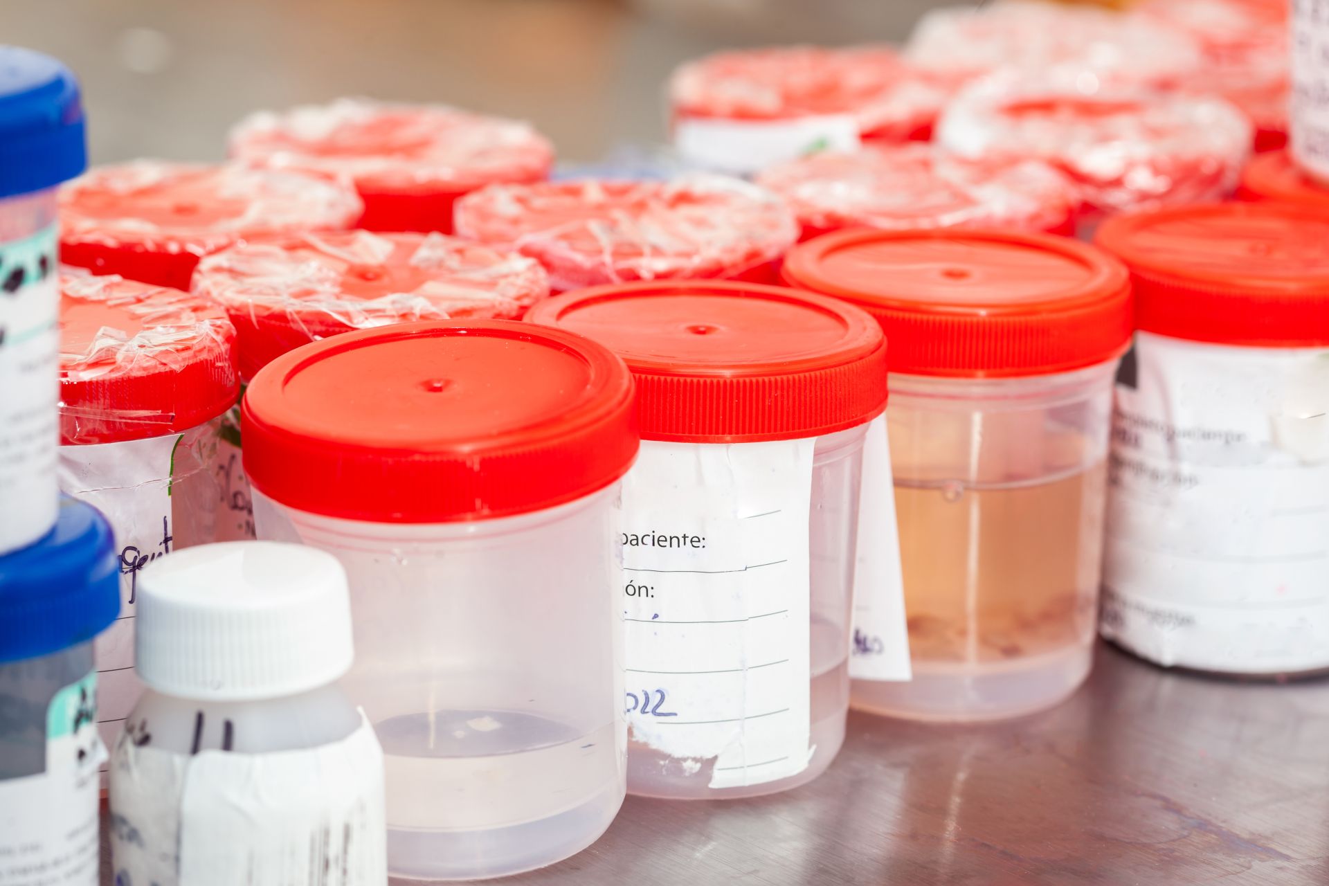 The Basics of Formalin Fixation