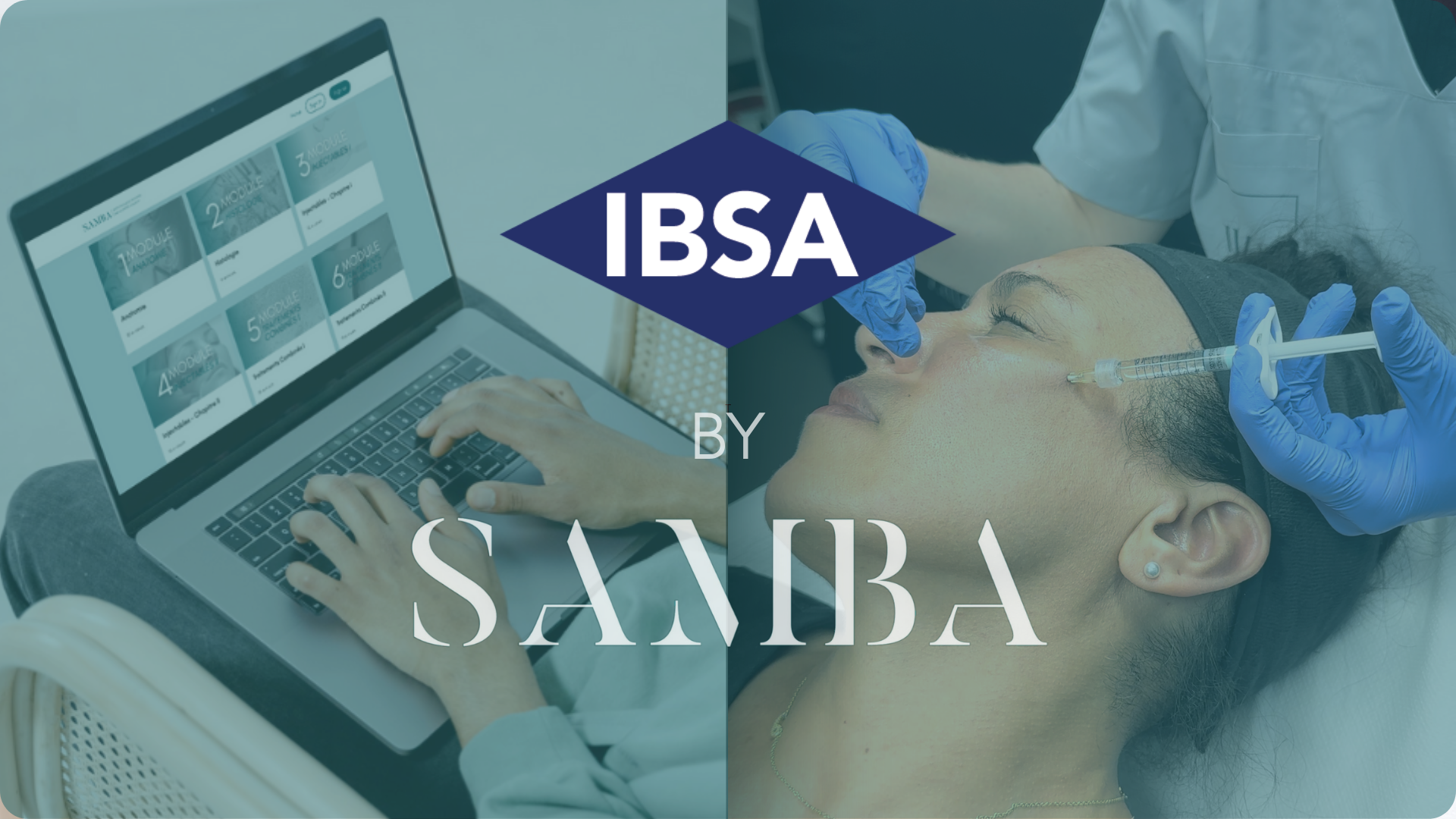 IBSA by SAMBA