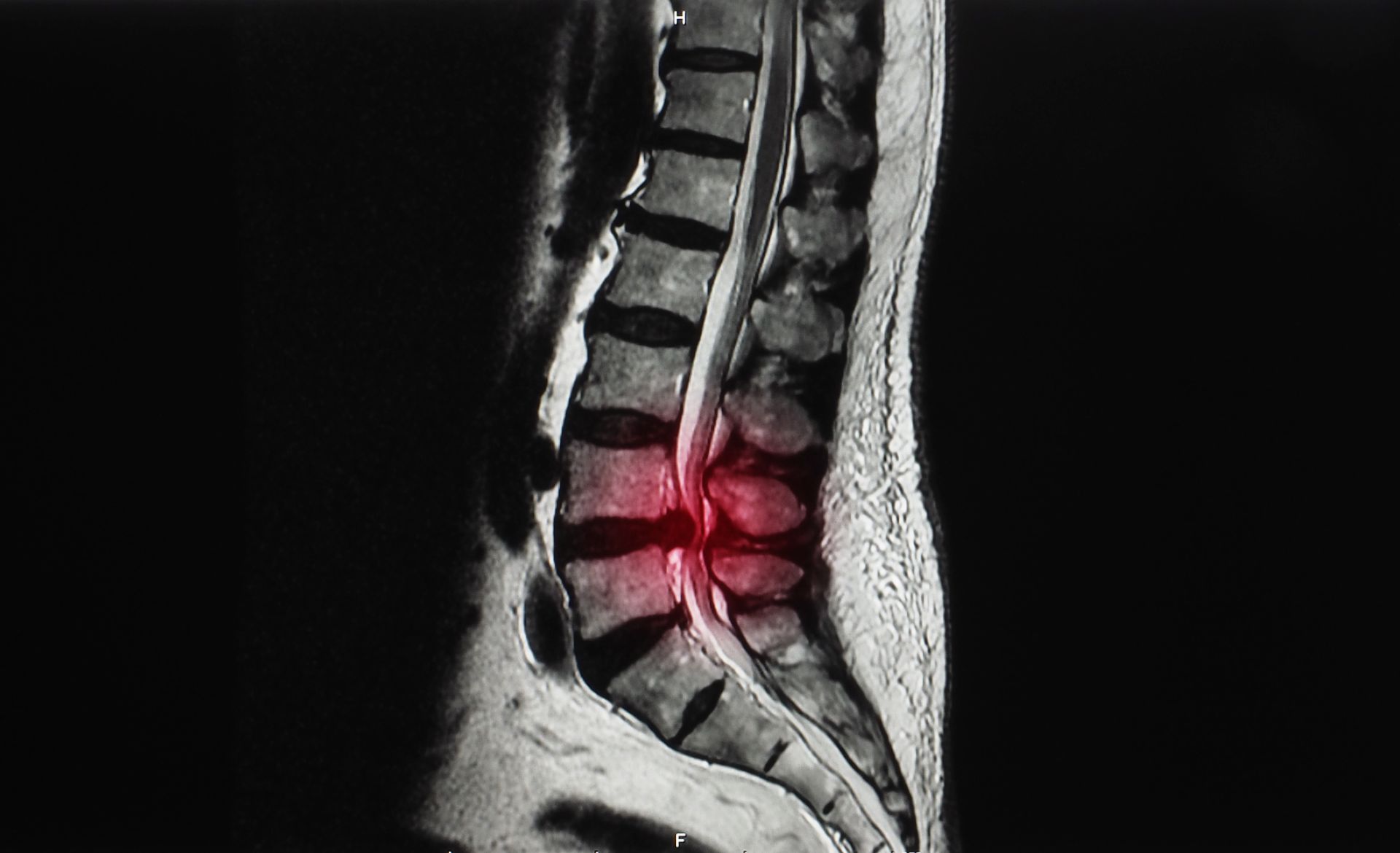 [MRI online] Critical Concepts In Spinal Imaging part. 2