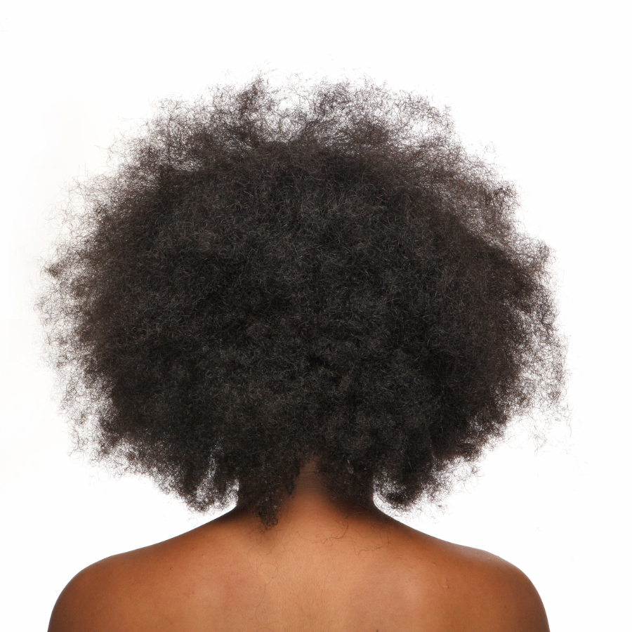 Hair Transplantation for Afro-textured Hair
