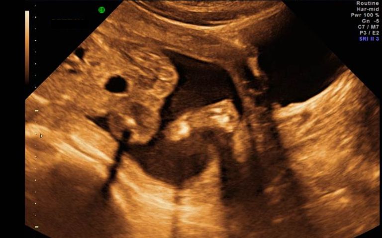 Second and Third Trimester Point-of-Care Ultrasound (POCUS) Course