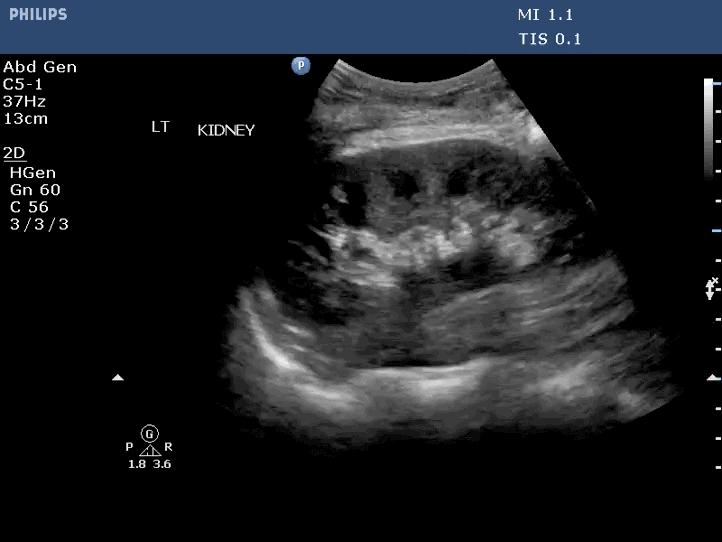 Focused Renal Ultrasound: Online POCUS Course for Kidney Function