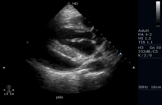 Focused Echocardiography A Comprehensive Online Pocus Course