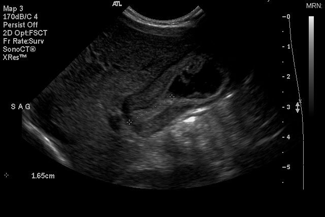 Pediatric Abdomen Ultrasound: Online POCUS Course for Physicians