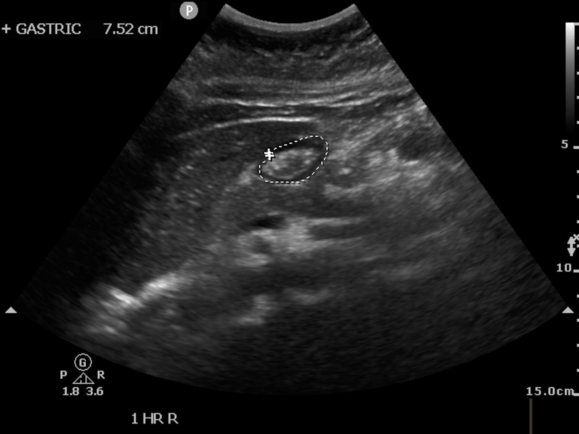Emergency Medicine Gastric Online POCUS Course