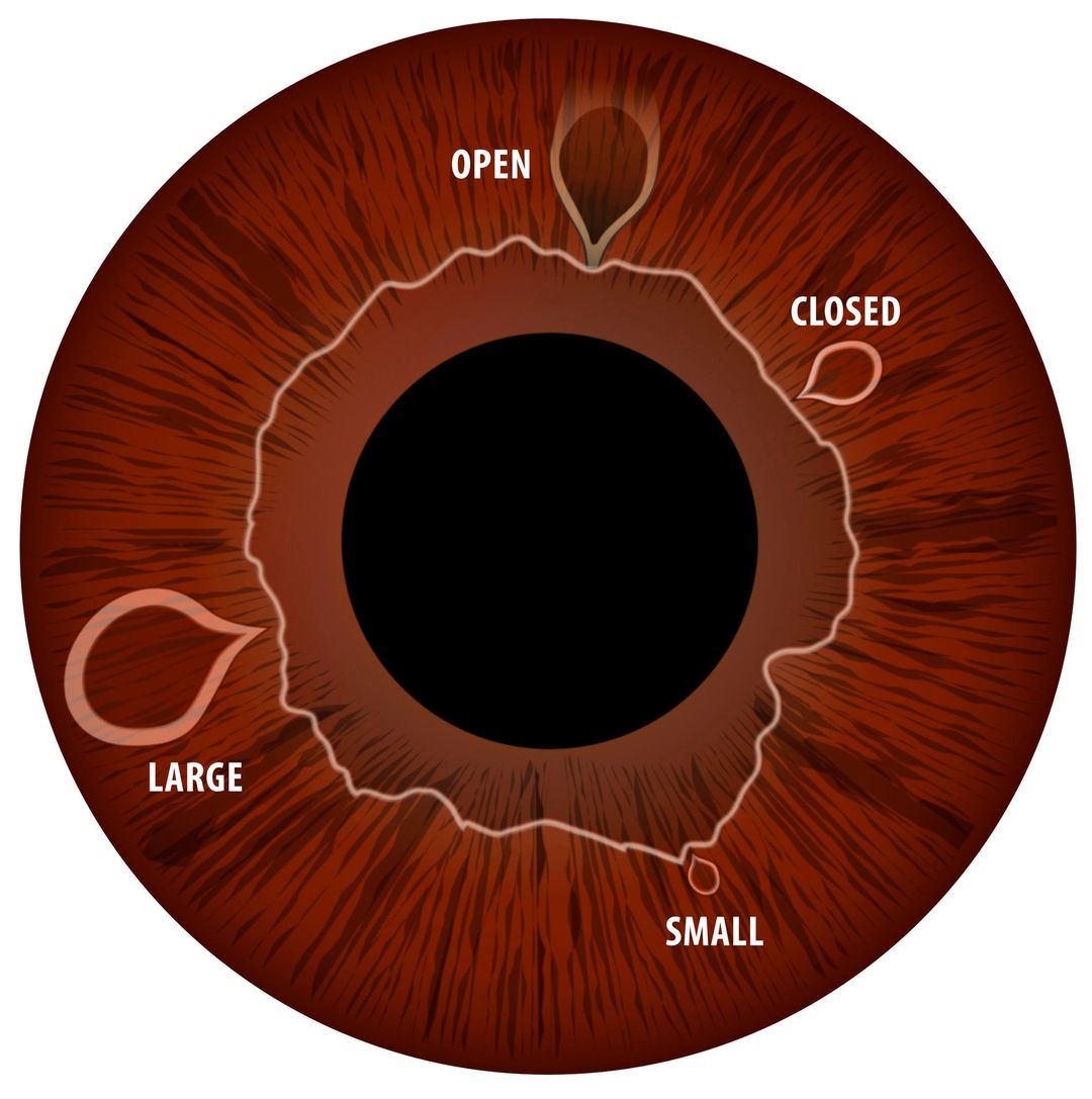 Categorisation of Lacunae according to Behavioural Iridology