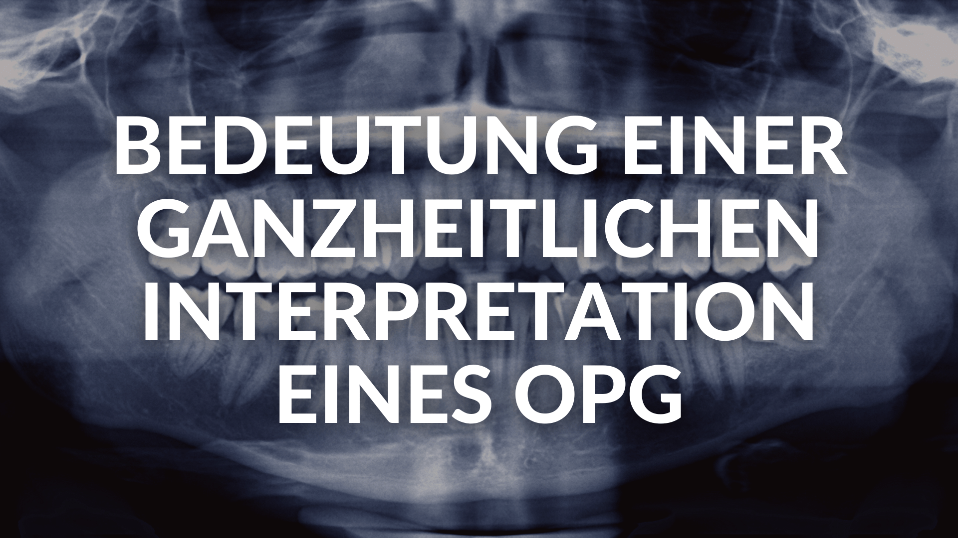 Die Bedeutung einer ganzheitlichen Interpretation eines OPG