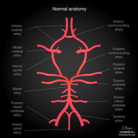 Neuroanatomia do Sistema Vertebrobasilar