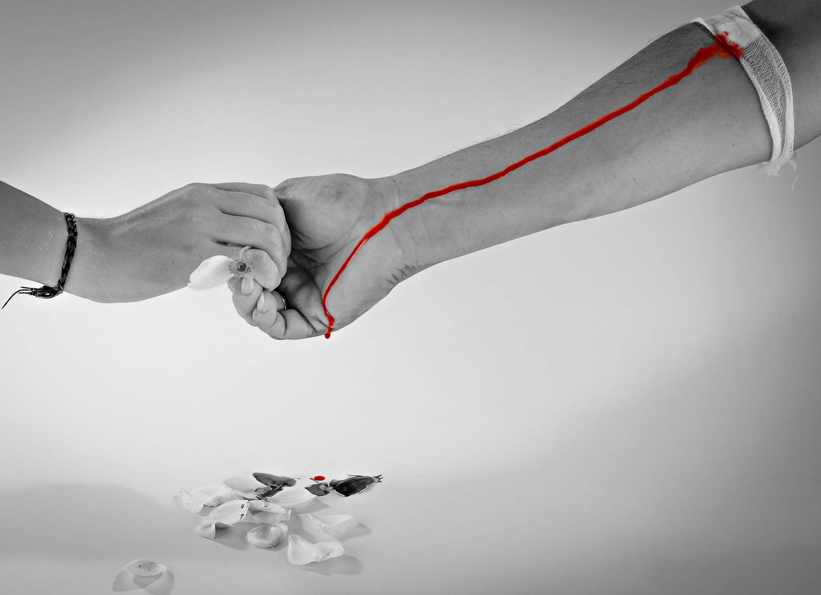 Vascular Access Dislodgement