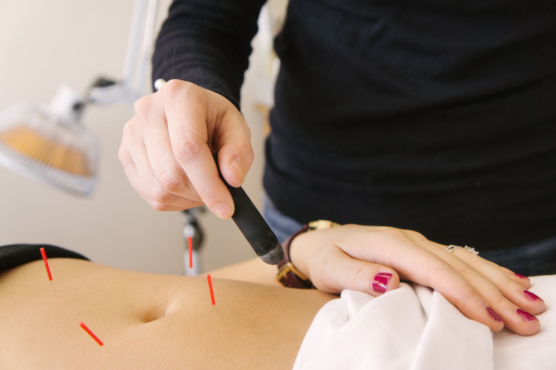 How to Get the Most Out of Your Acupuncture