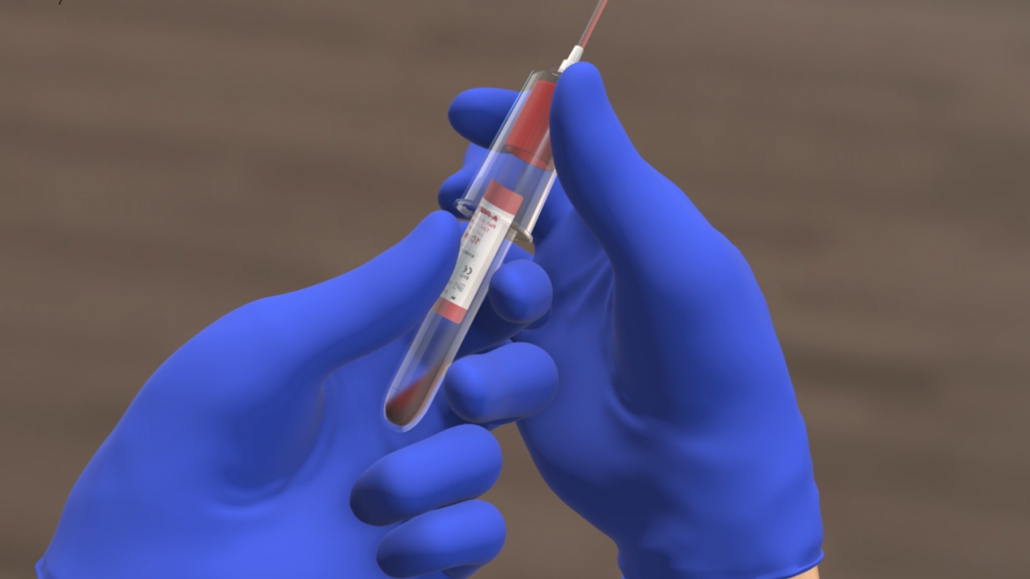 1) Venipuncture For Blood Concentrates Inside Dental Office