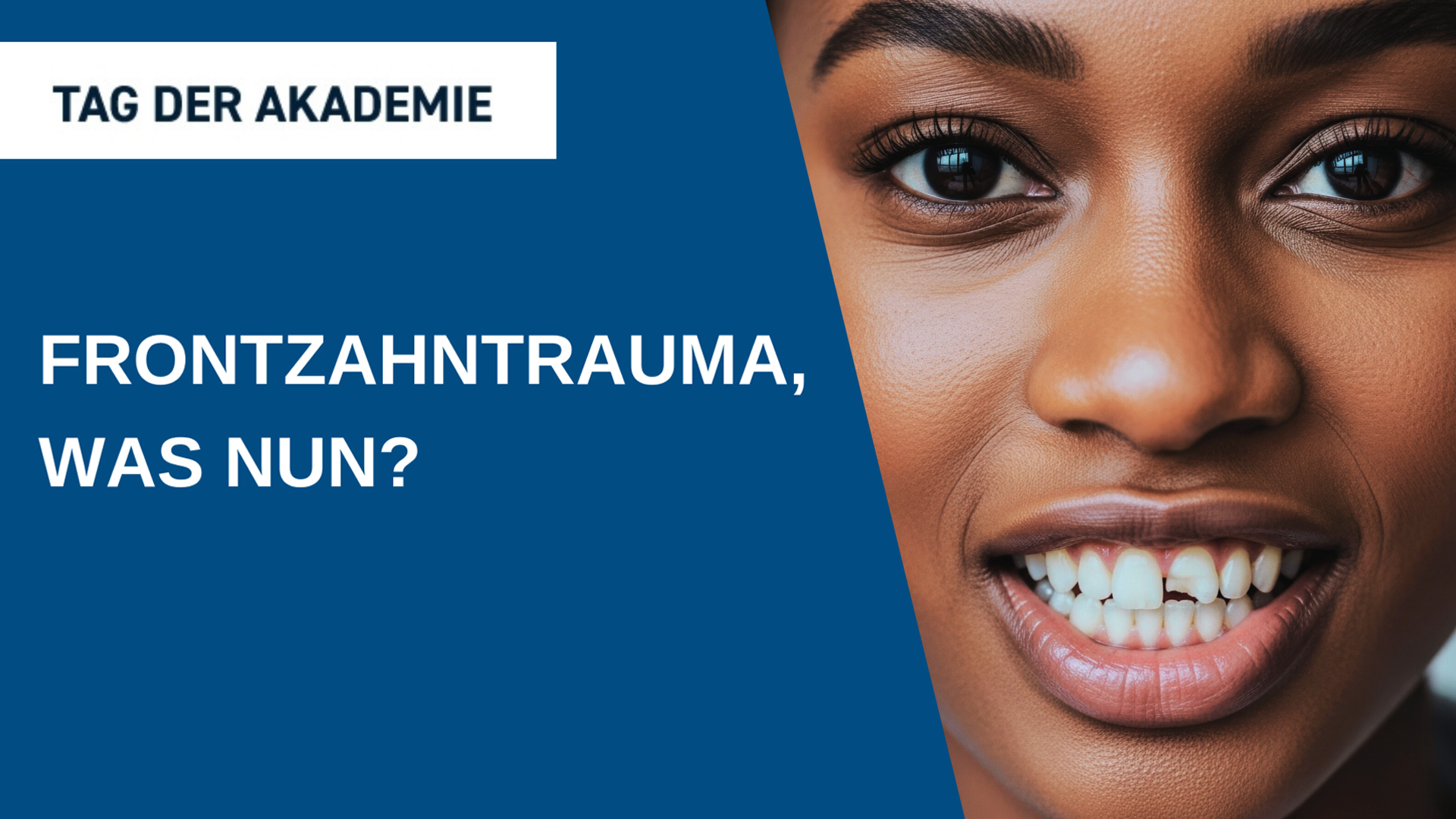 Tag der Akademie 2025 - Frontzahntrauma, was nun?