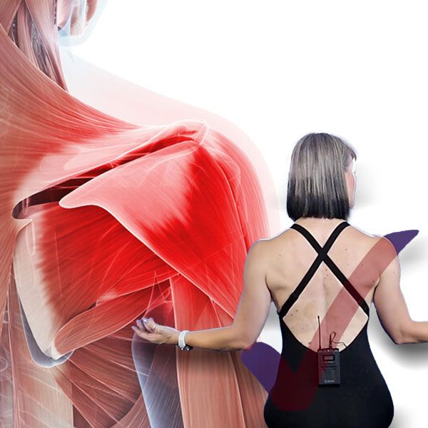 Shoulder Stability Biomechanics