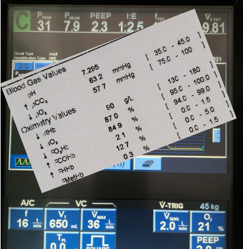 Making Changes to the Ventilator Using ABG