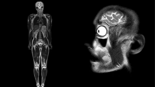 Foundational MRI
