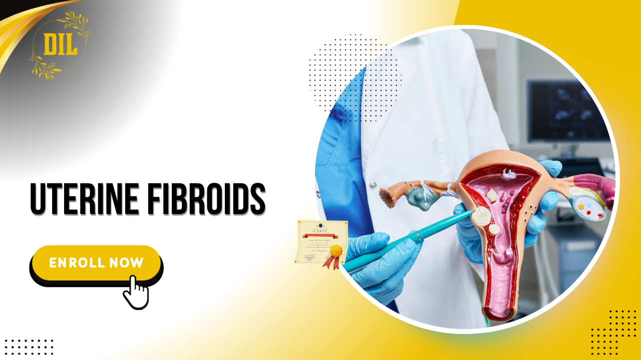 Uterine Fibroids
