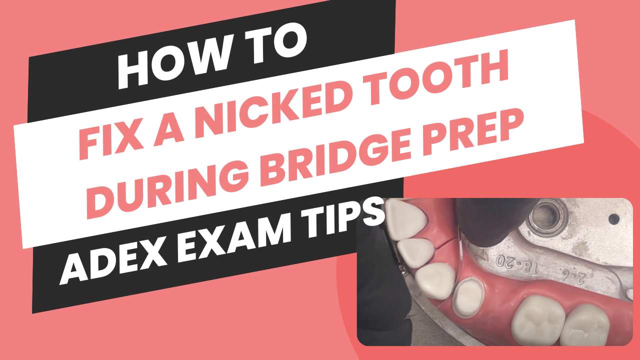 How To Smooth the Adjacent Tooth If You Nick It During Your Bridge Prep!