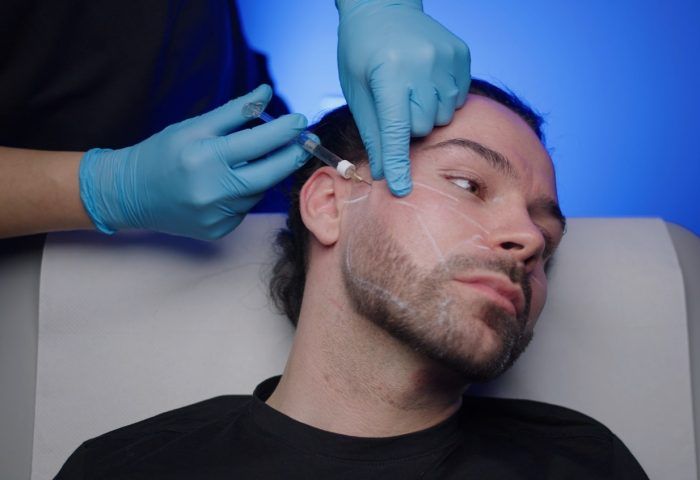 Full Facial Transformation Series | Online Botox & Dermal Filler ...
