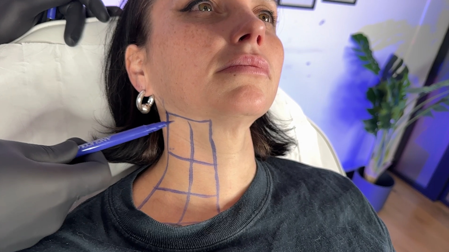Live Injecting Webinar: A Neck Masterclass