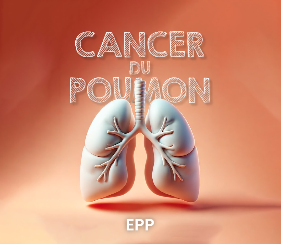Améliorer le diagnostic du cancer du poumon en médecine générale