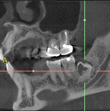 3D CBCT Diagnostics in Today’s Practice