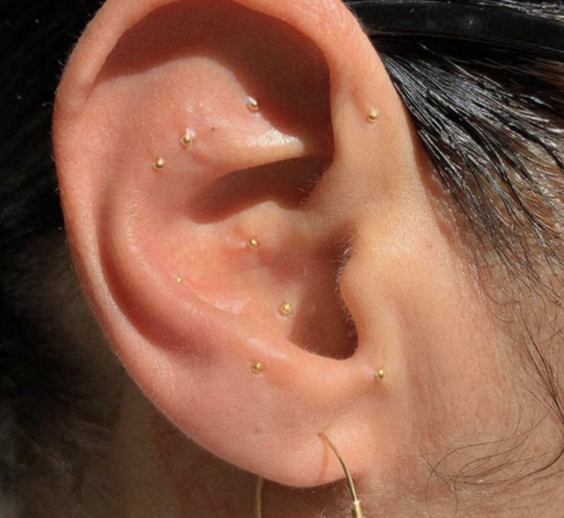 Auricular - Ear Seeding