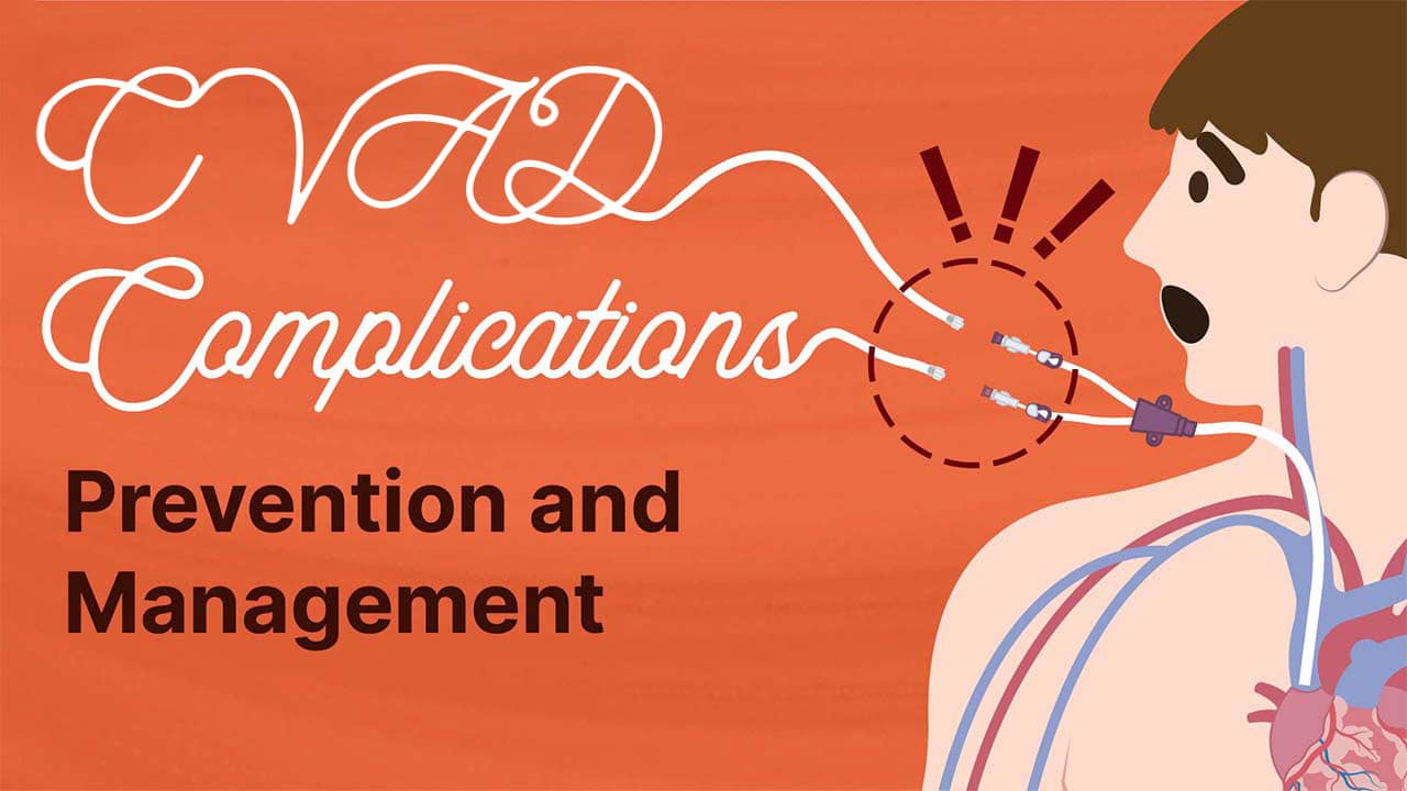 CVAD Complications: Prevention and Management - free online course