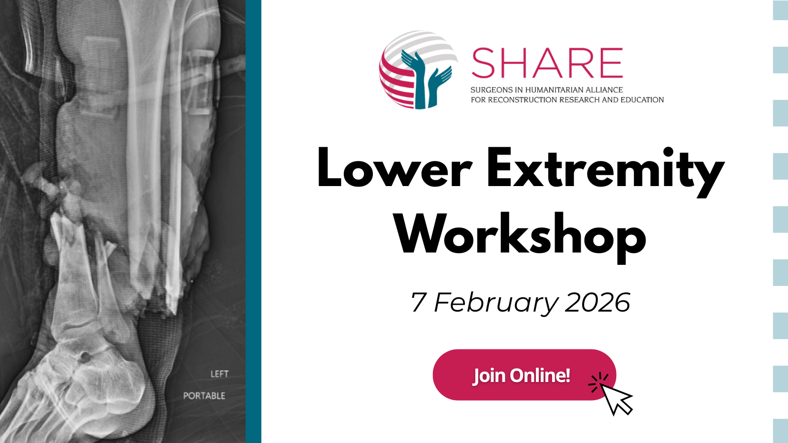 Join the Lower Extremity Workshop