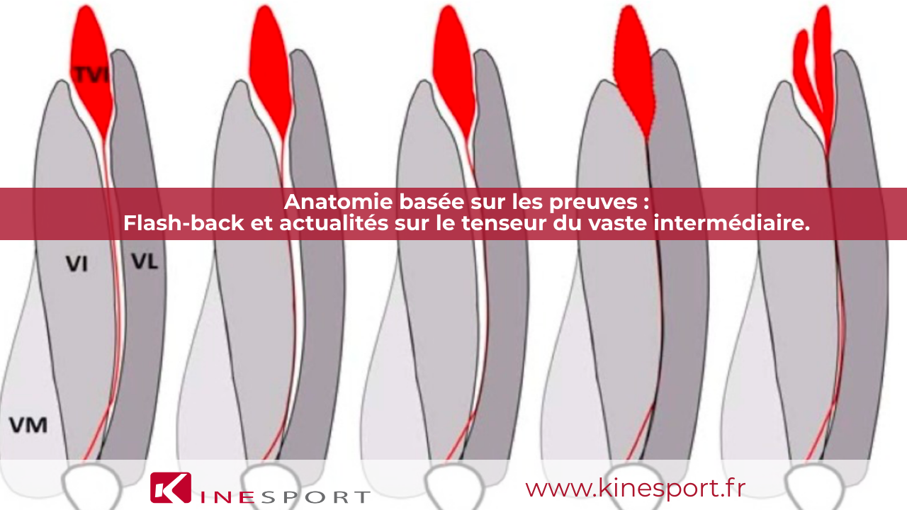 Flash-back et actualités sur le tenseur du vaste intermédiaire - Blog ...