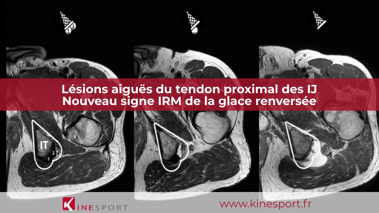 Bonne fiabilité de l'évaluation standardisée par IRM de la ...