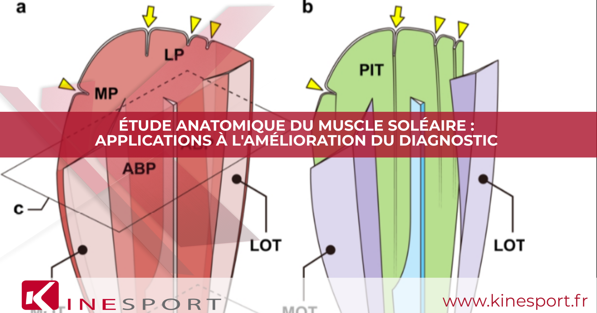 ÉTUDE ANATOMIQUE DU MUSCLE SOLÉAIRE - Blog Kinesport