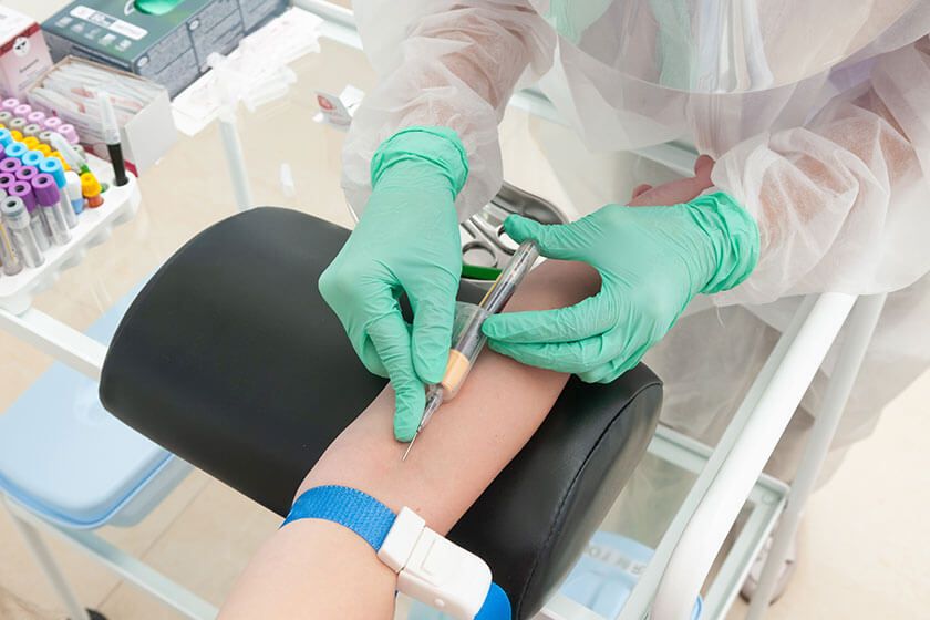 Top 10 Tips for Perfecting Your Venipuncture Technique