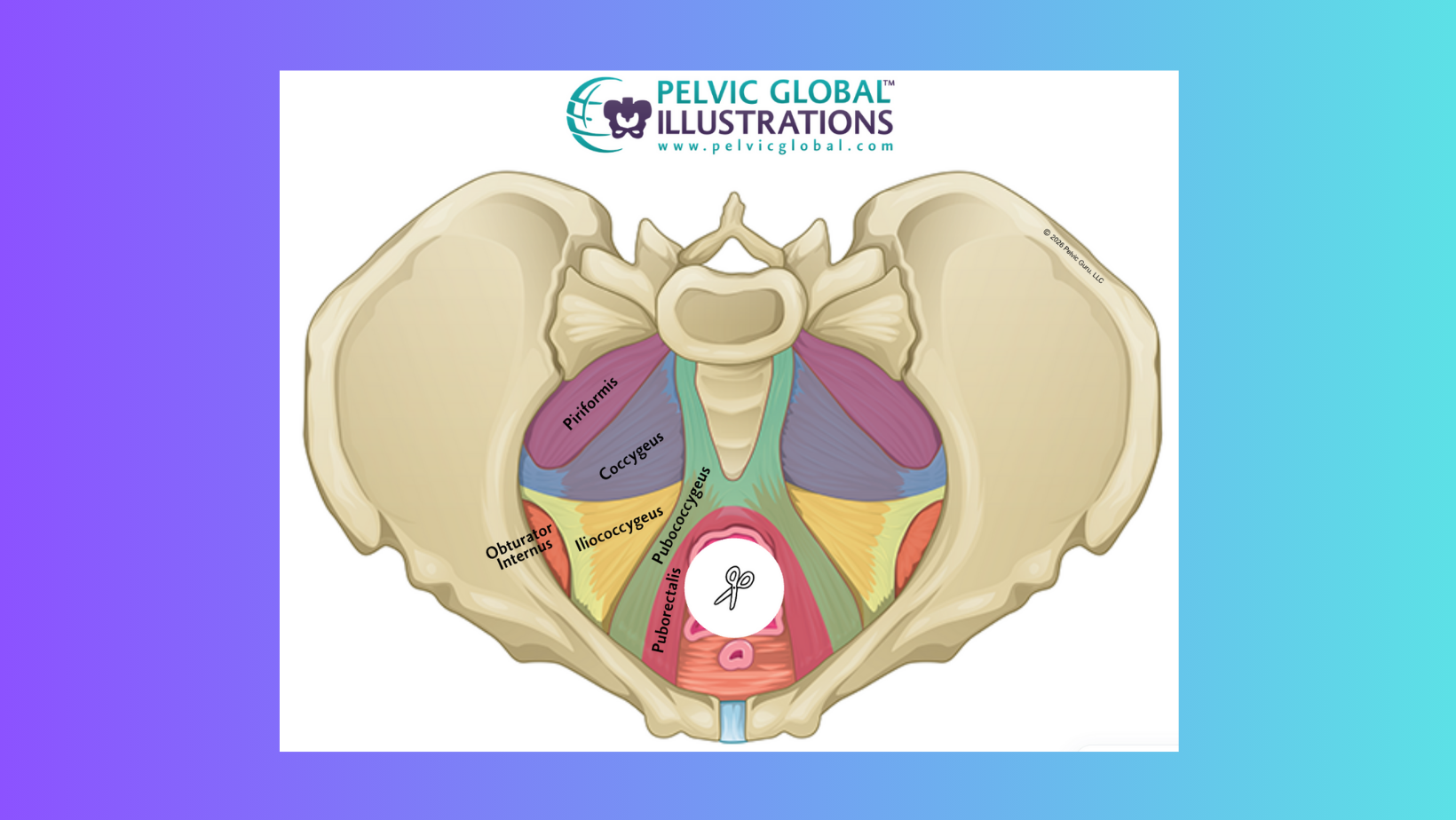 Pelvic Floor Demo Cutout: Handouts (1)