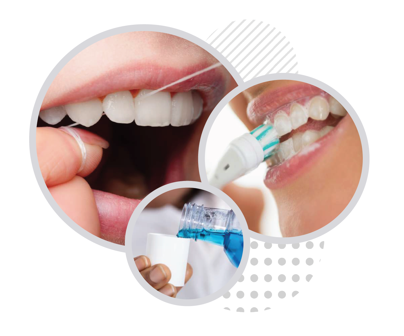 Oral Health And Prevention: From Fluoride to Sealants, Coronal ...