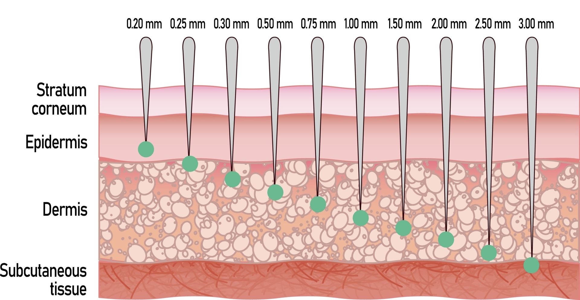 Needle Depth in the Skin Explained: Understanding Skin Layers for Safe ...