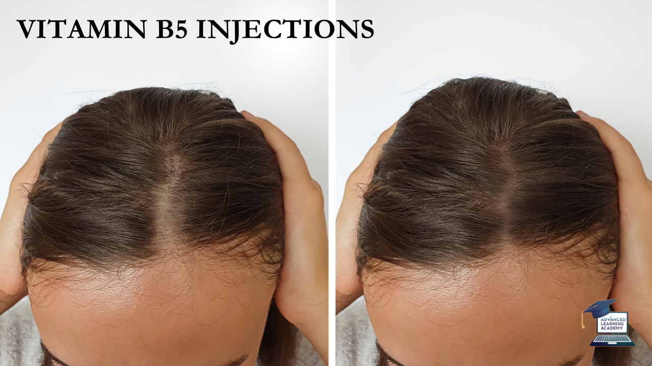 Vitamin B5 Injections