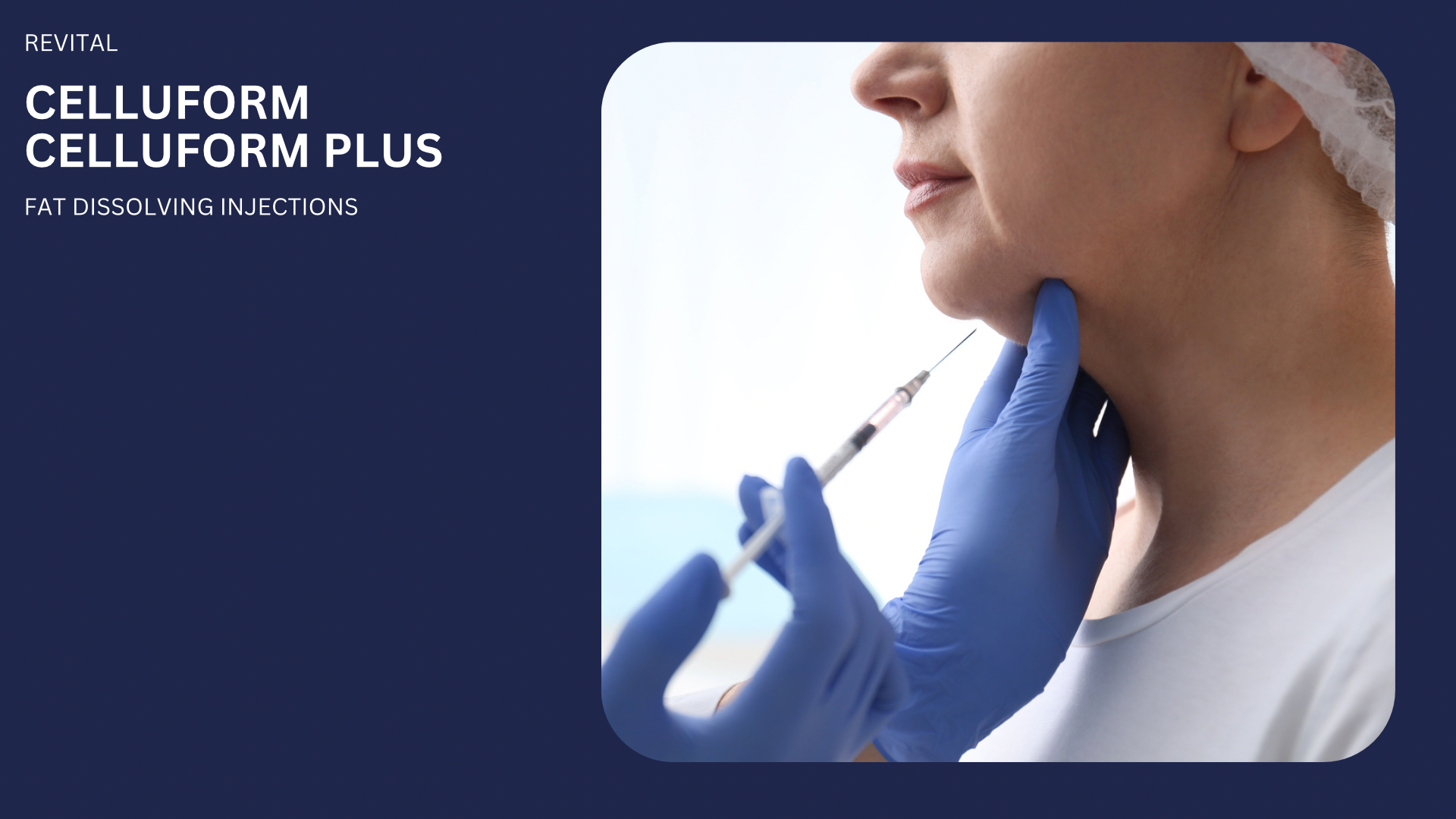 Celluform Fat Dissolving & Anti-Cellulite Injections