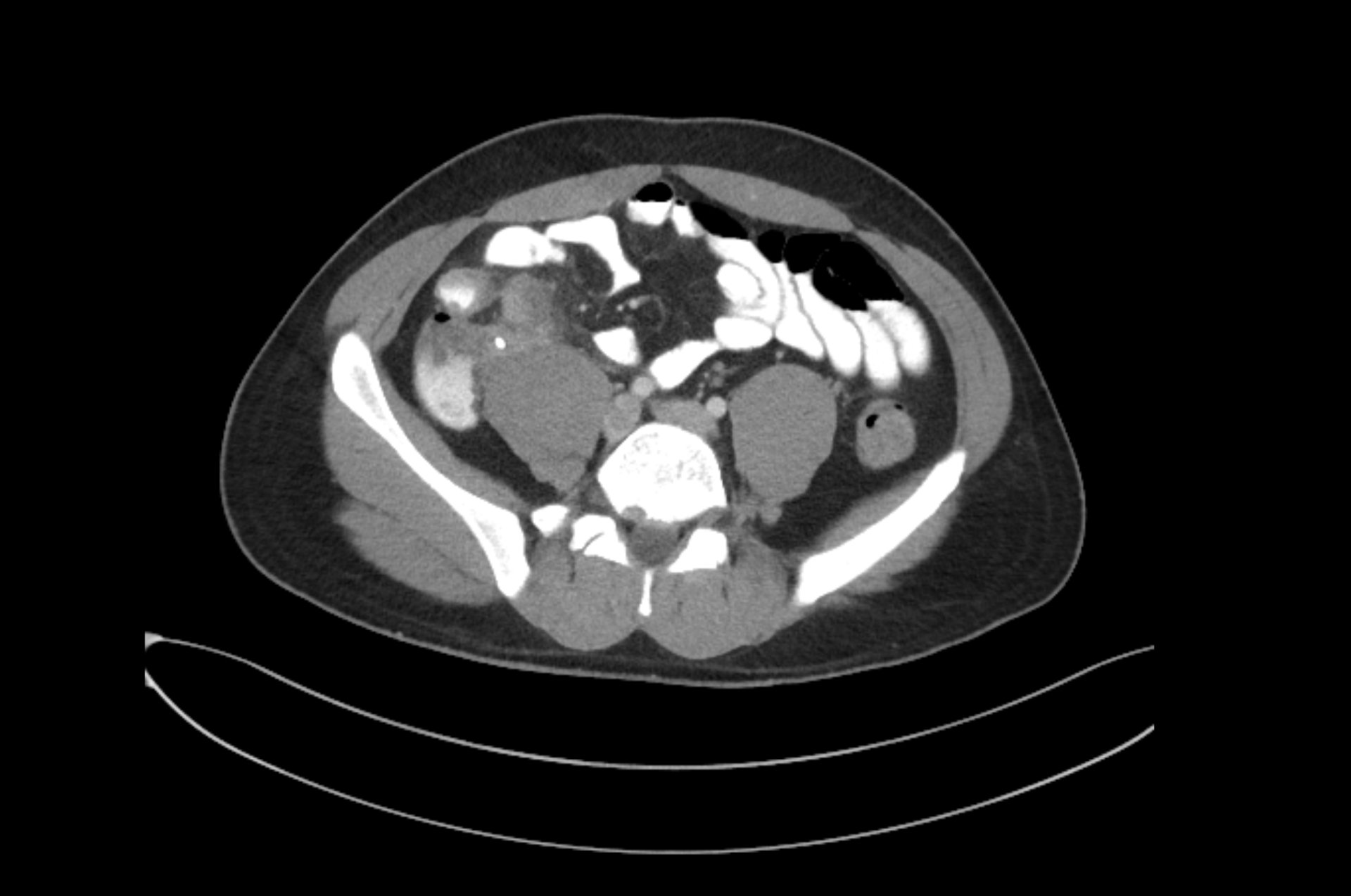 Abdominal Imaging OSCE