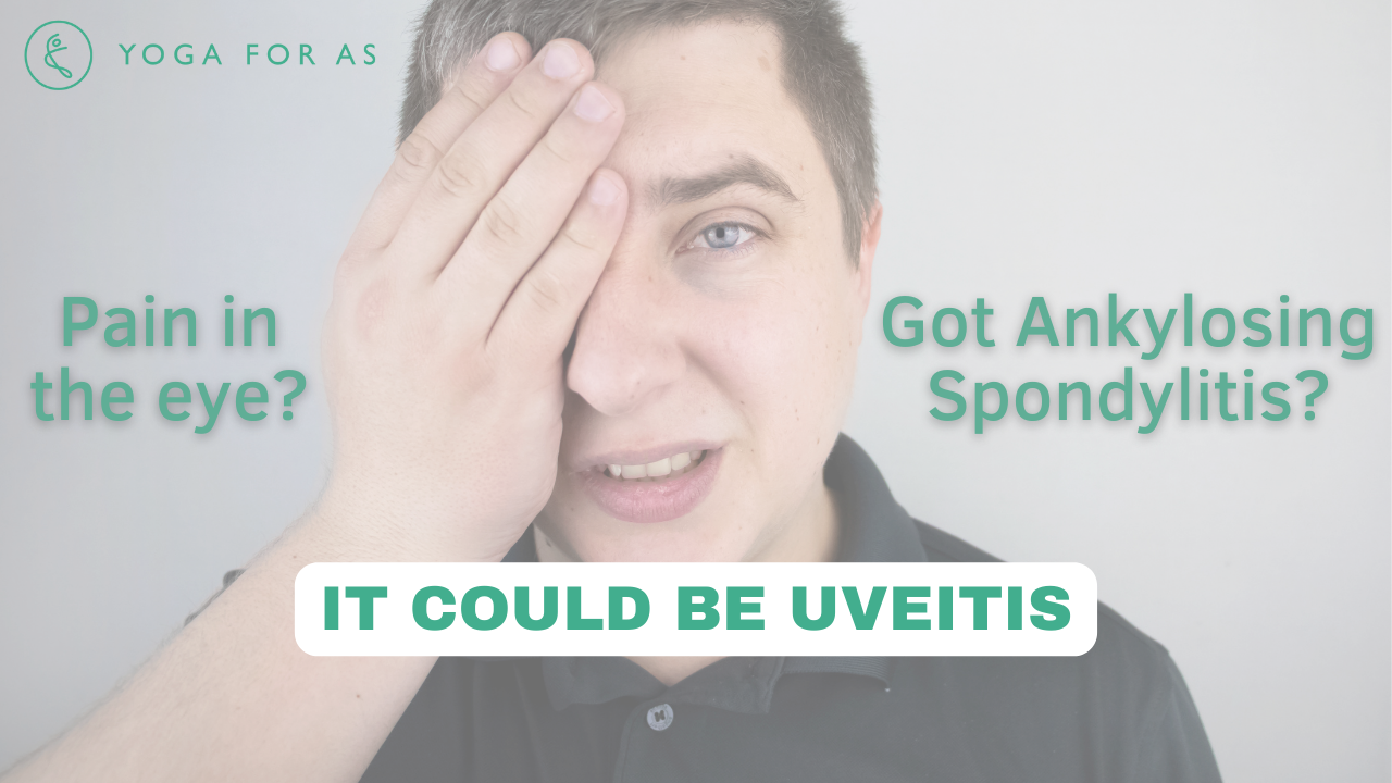 Ankylosing Spondylitis affecting your eyes?